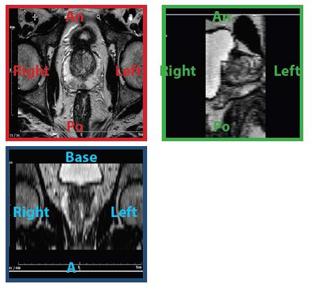 Urologie: technologie Koelis (Pro) | AVF Biomedical
