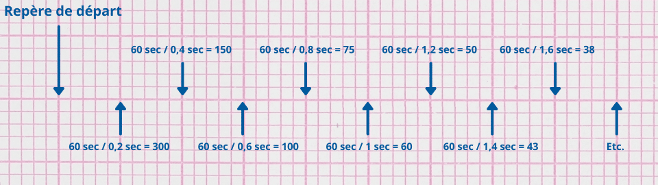 Calculer la Fréquence Cardiaque Avec un ECG | AVF Biomedical Calculer la Fréquence Cardiaque Avec un ECG | AVF Biomedical