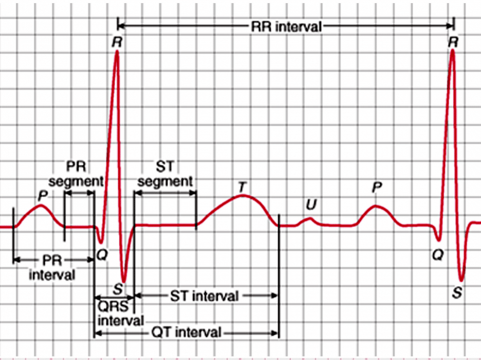Que Représente le Signal ECG | AVF Biomedical
