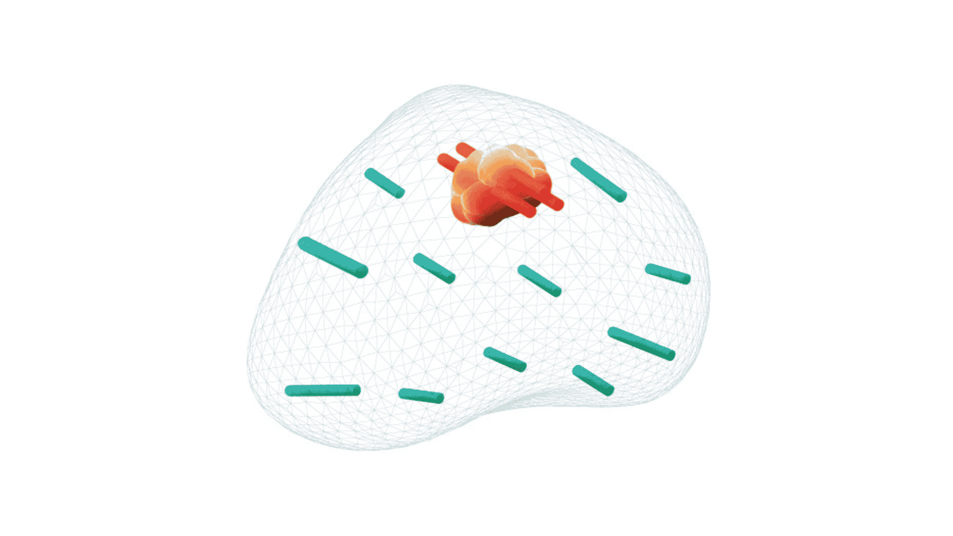 Symptômes Cancer de la Prostate | AVF Biomedical